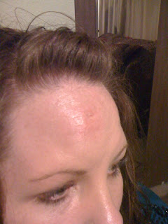 When Two Became Three...: The Bane of my Existence aka Cellulitis