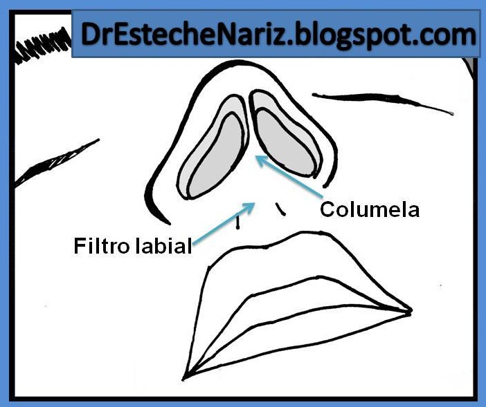 Dr Esteche | Rinoplastia | Cirugía | Plástica de Nariz | Nose |Surgery ...