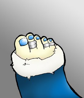 castgirls: Art: Cast and Toe Rings