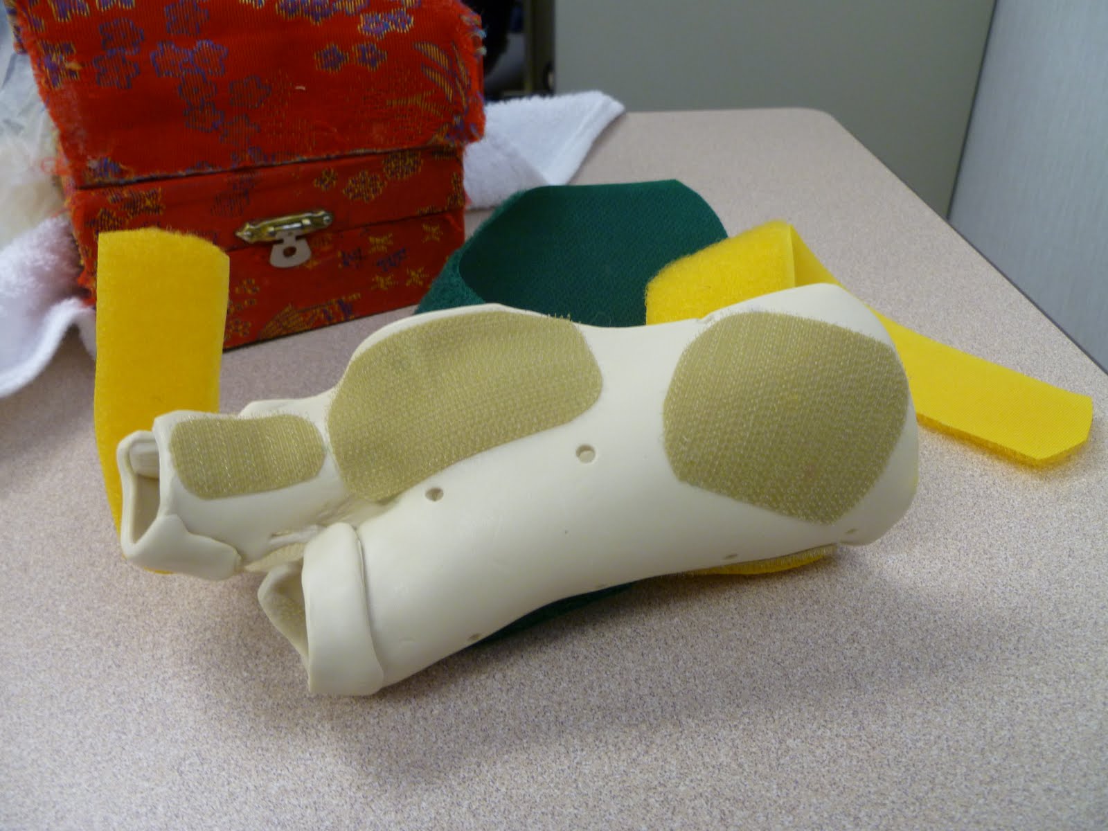 Adventures in Splinting: DIP Blocking Exercise Splint