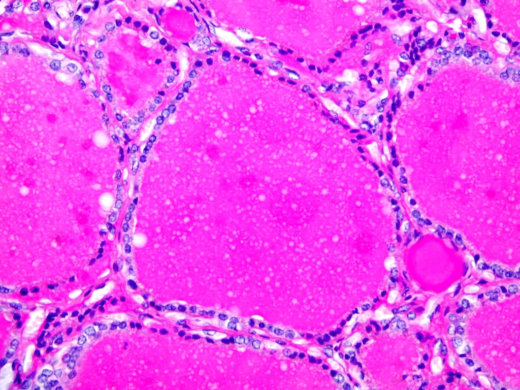 SOS BIOLOGIA CELULAR Y TISULAR: ENDOCRINO ¿QUE GLANDULA ES?
