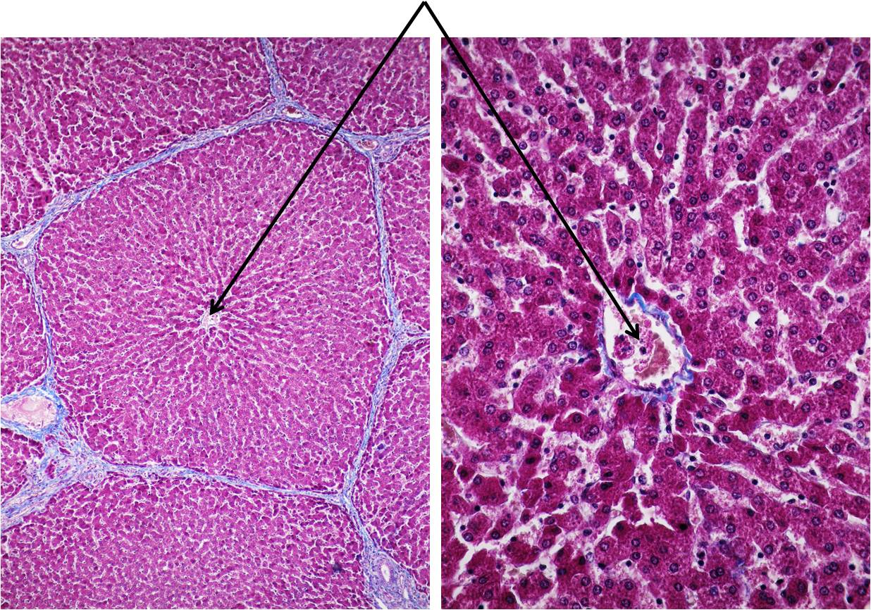 SOS BIOLOGIA CELULAR Y TISULAR: DIGESTIVO. HIGADO