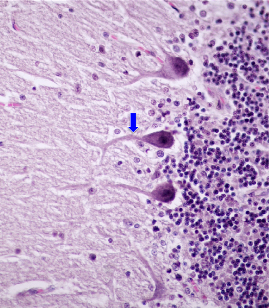 SOS BIOLOGIA CELULAR Y TISULAR: TEJIDO NERVIOSO. CEREBELO 1