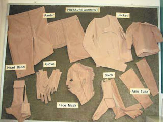 Burn Support Group Singapore: Pressure control for burns recovery