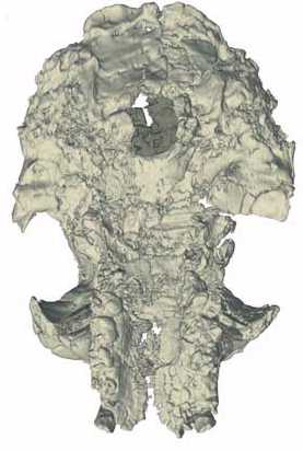 Sinanthropus: A Chinese Ape in Our Ancestry?