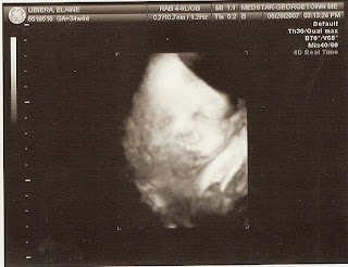 BabyUbiera: 4D ultrasound - 34 weeks