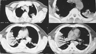 QuickMd: Información, Videos, Libros de medicina Gratis: Rx y TC de ...