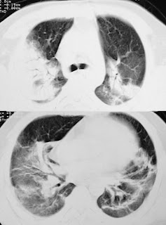 QuickMd: Información, Videos, Libros de medicina Gratis: Rx y TC de ...