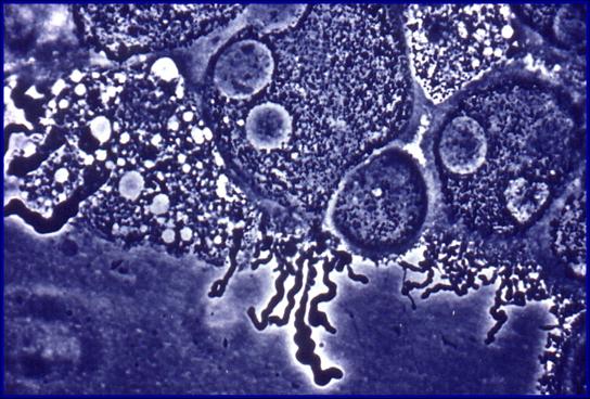 yNfOrMaTiik: [:[:[_Microscopía_]:]:]