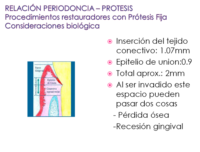 PERIODONCIA PARA PRINCIPIANTES: ESPESOR BIOLOGICO