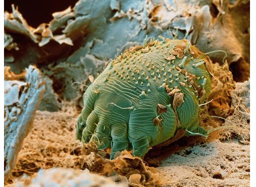 always niezma: scabies - penyakit kudisan, gudikan, budugan.