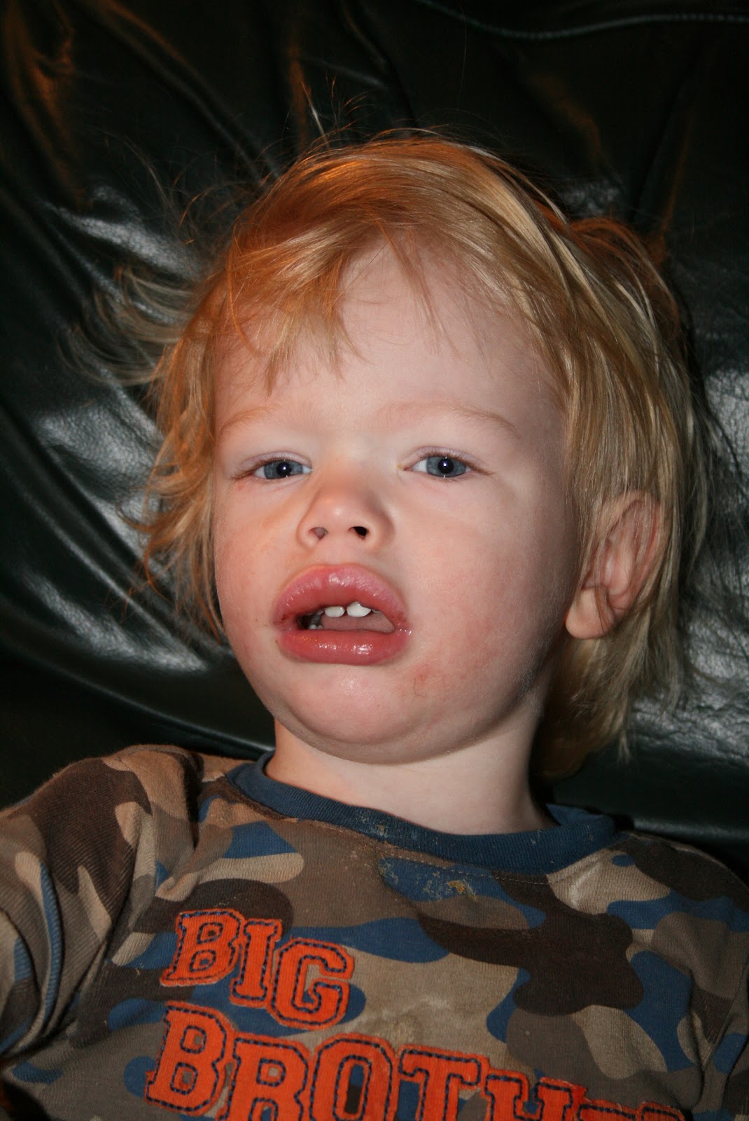 Jessie, Brandon, Sam & Jack!: Poor Sammy and His Fat Lip