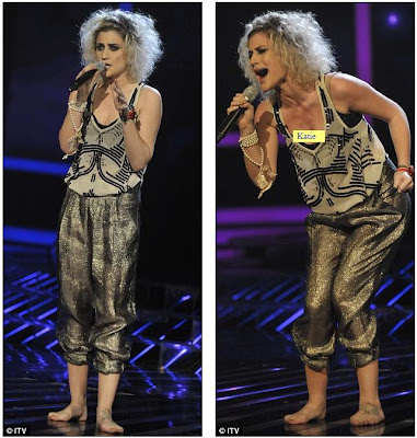 Ancurit Kabeh: simon cowell teeth before and after