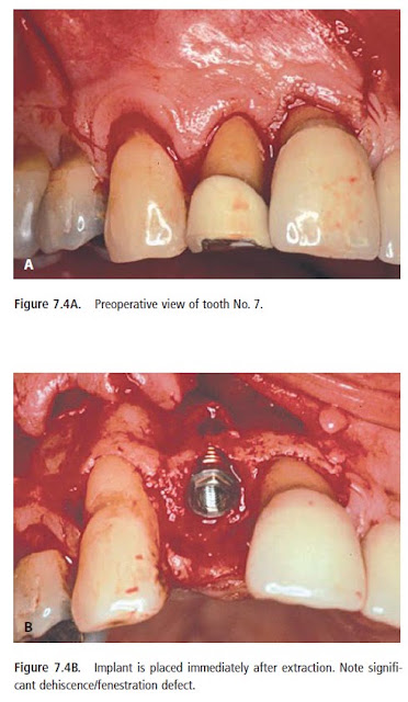Perio and Implant dentistry overview
