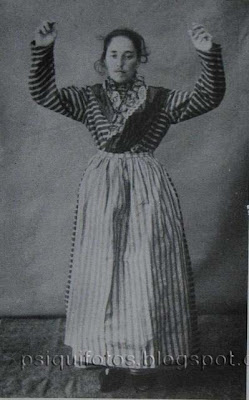 Imágenes de la psiquiatría: 162. La Catatonia. 5) En algunos atlas de ...