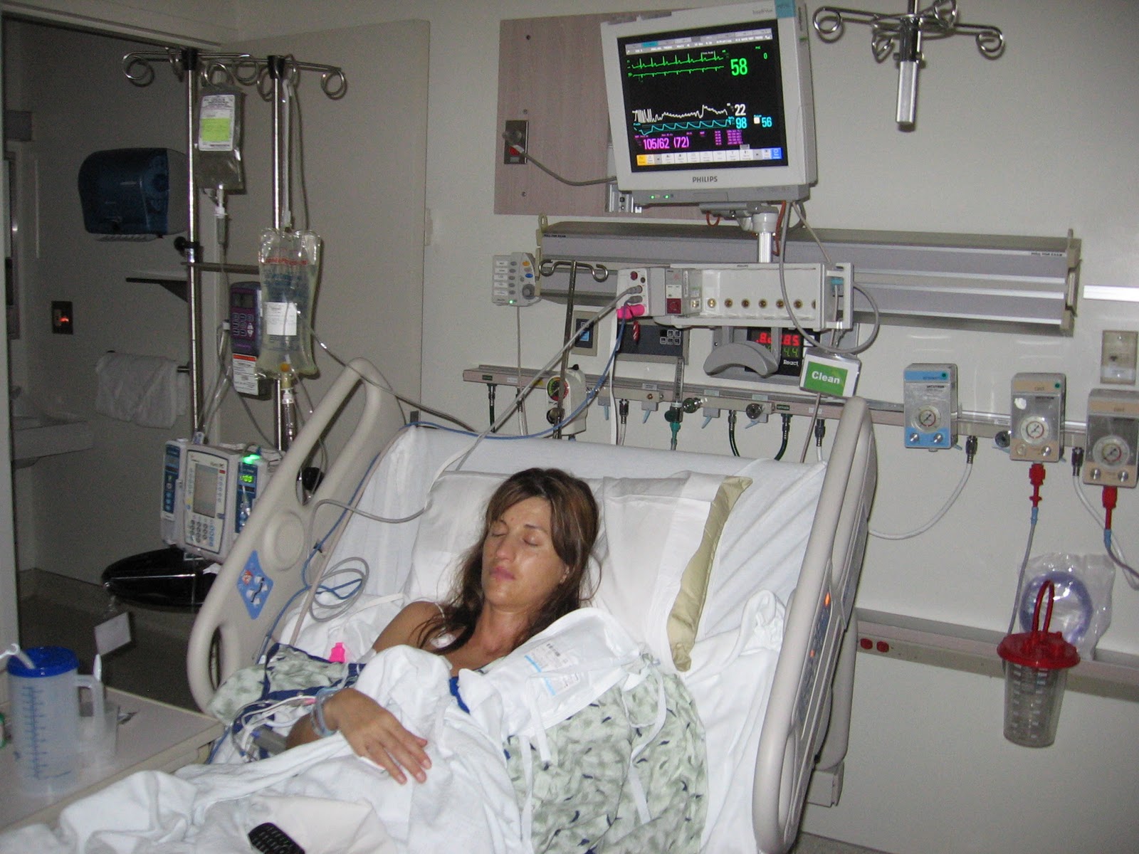 Thoracic Outlet Decompression Surgery – CREM