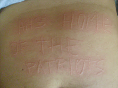 CoOl---ThInGs---2C!!: Dermatographism