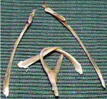 Per 2 Lab Table 2 Physio BLab: Ex 8: Bone Classification, Structure ...