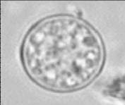 Cryptosporidium y Cyclospora: CYCLOSPORA