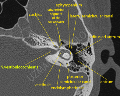 TEMPORAL KEMİK(TEMPORAL BONE) - KAFA TABANI (SKULL BASE) ANATOMİSİ