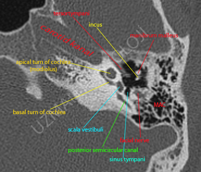 TEMPORAL KEMİK(TEMPORAL BONE) - KAFA TABANI (SKULL BASE) ANATOMİSİ