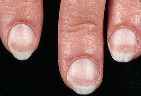 Nails and Health: Read the Signs ~ HEALTHCARE NEWS