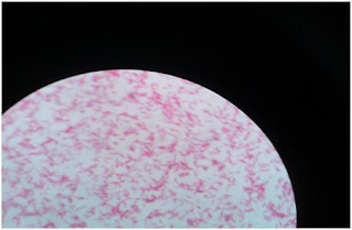 Pharmacy care is no 1 ..: Pewarnaan Gram