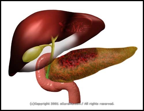 Share Medical Knowledge: Acute Pancreatitis