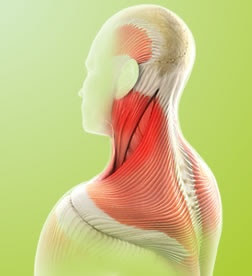 Fisioterapia Quintana: O QUE FAZER COM TORCICOLO?