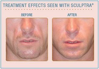 Plastic Surgery for Men: Plastic Surgery for Men QT: What causes facial ...