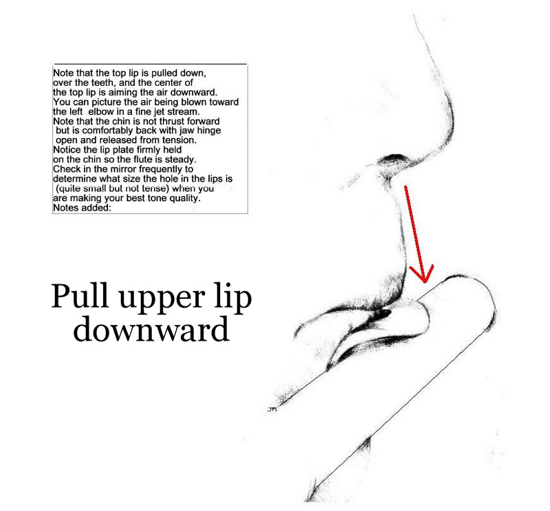 Jennifer Cluff: Top Teeth where Upper Lip should be