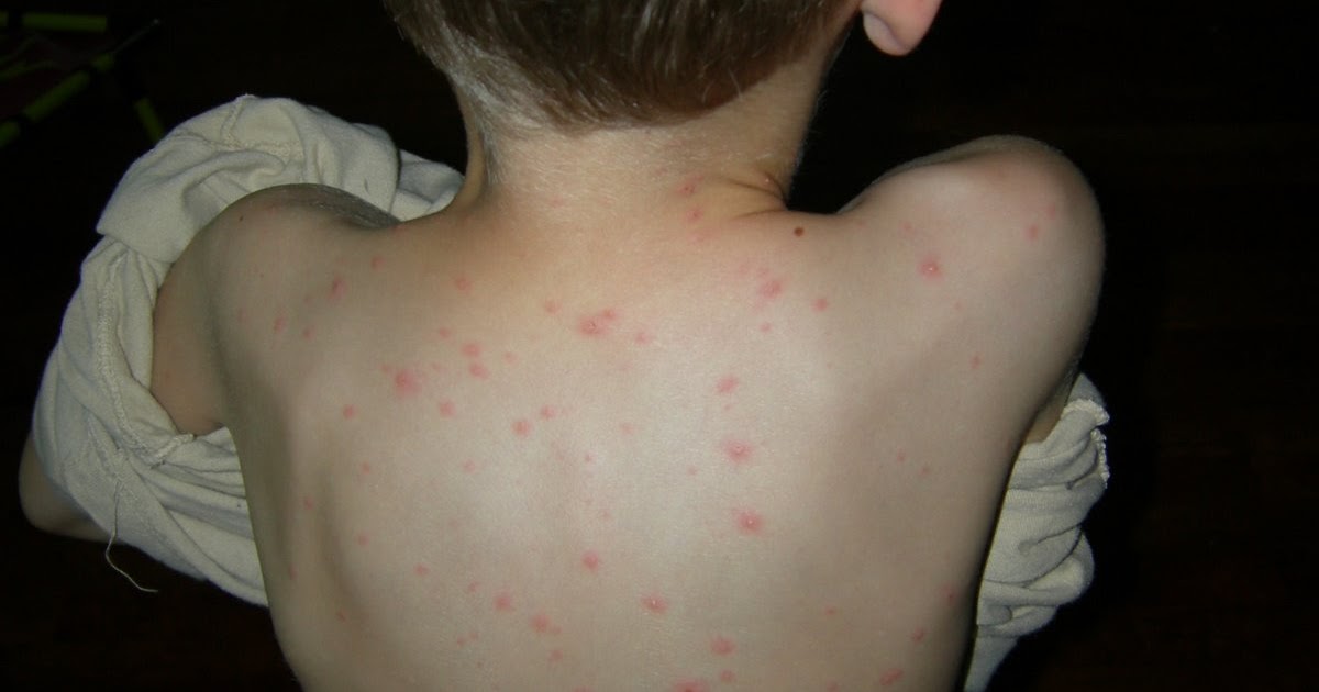 Post Oak Ranch: The "Chicken Pops" Strike