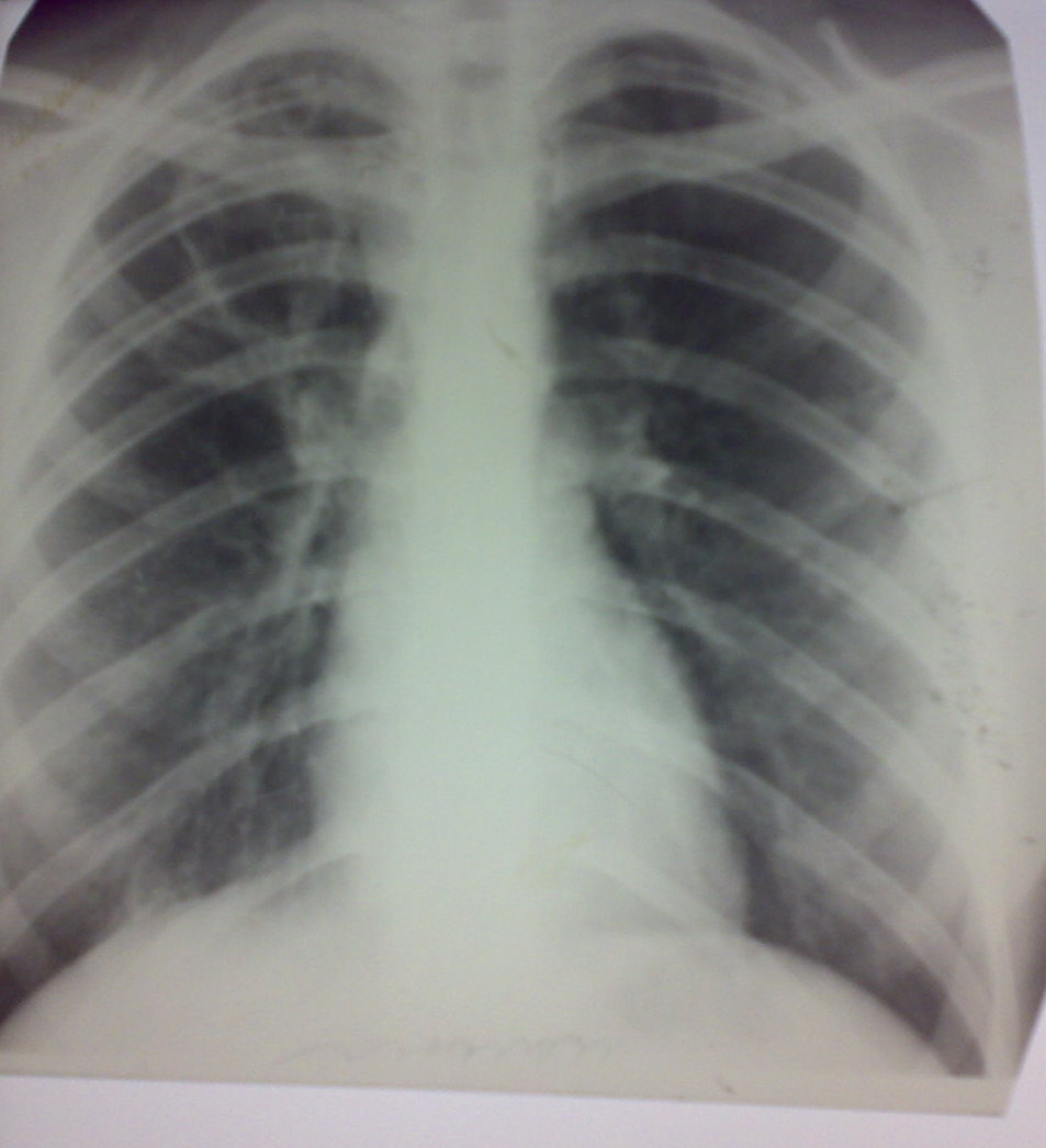 Будьте Здоровы! Be Healthy!