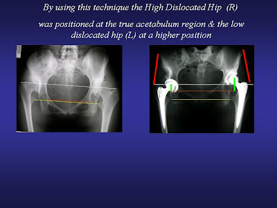 The High Hip Center: THE HIGH HIP CENTER.