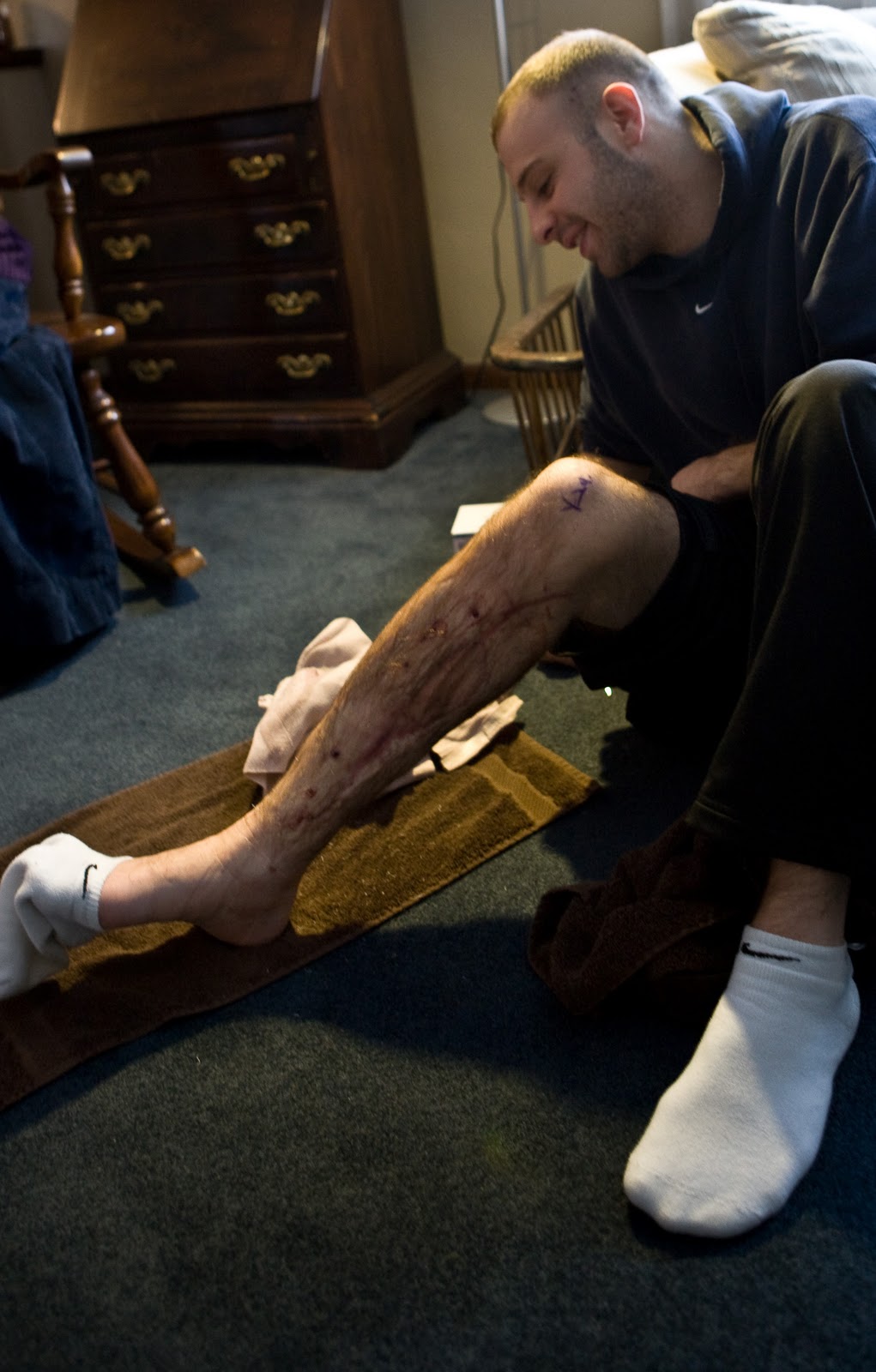 Recovery: Taylor Spatial Frame Removed