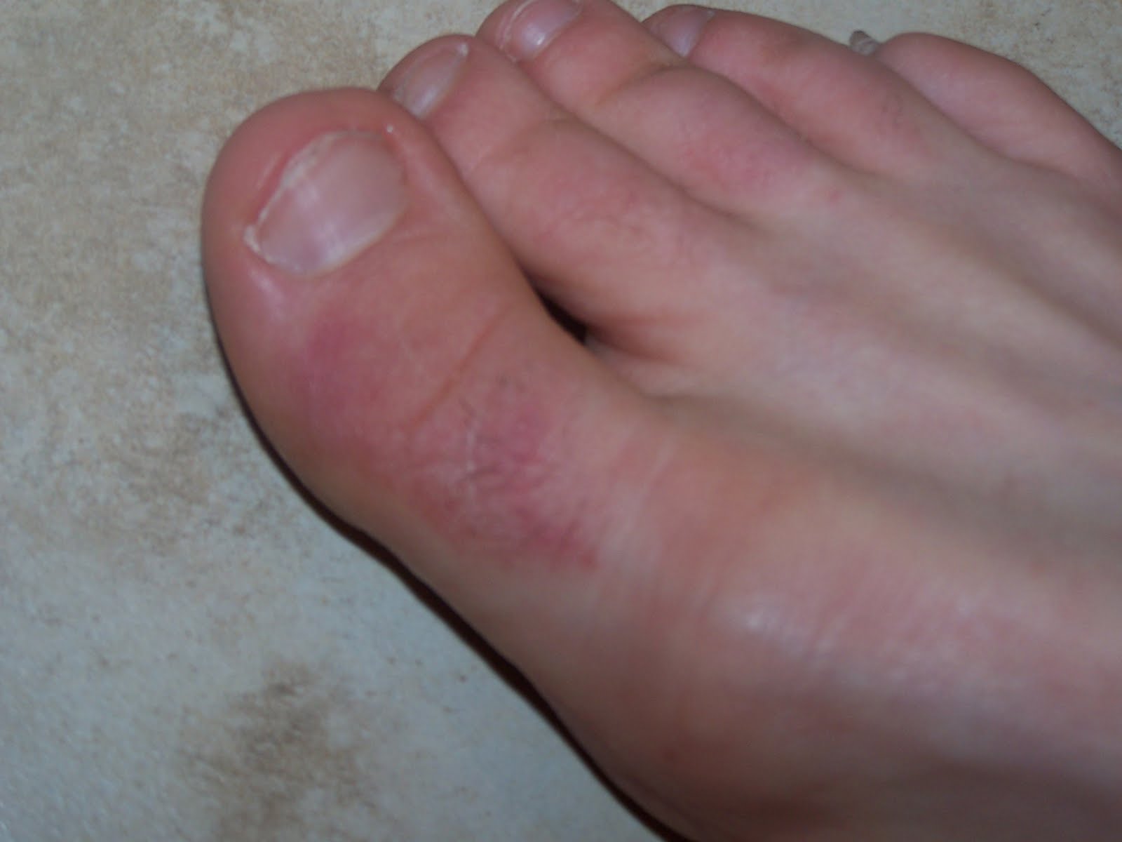 Our Mold story, and life after MOLD: health issues from mold toxicity