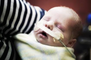 Phenylketonuria Care: Symptoms Of PKU Patient