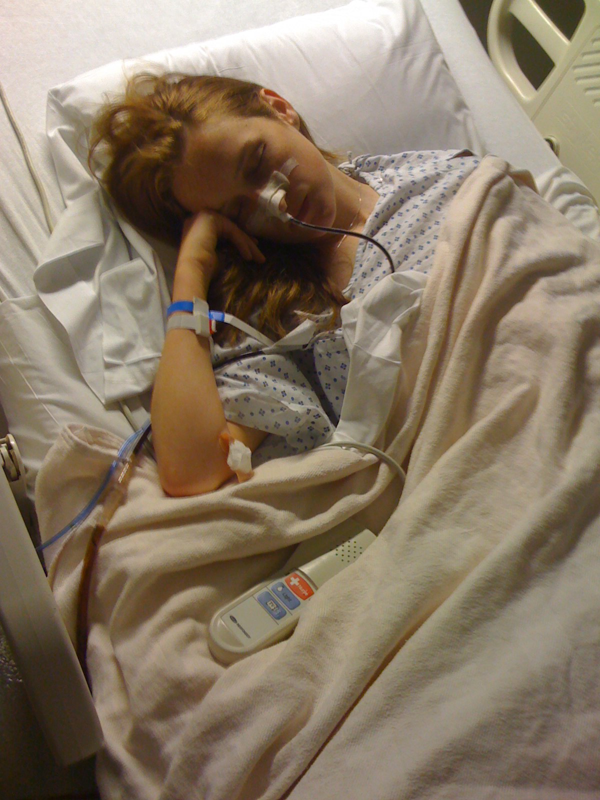 the swollen colon: Pictures