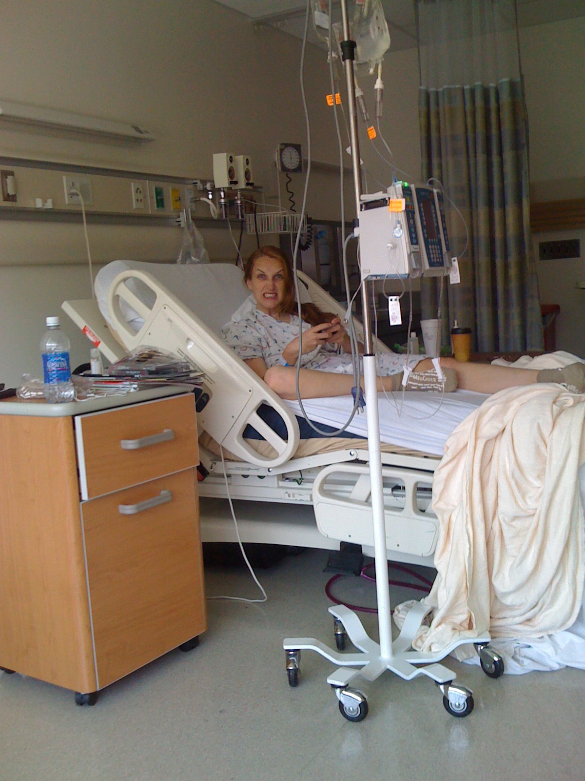 the swollen colon: Pictures