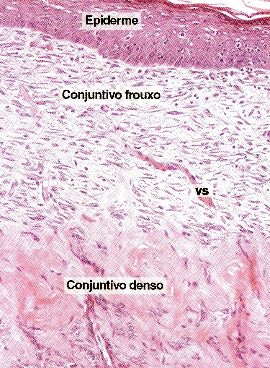 Tecido conjuntivo; Tecido Conectivo