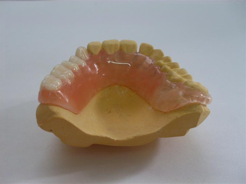 PROTESIS FLEXIBLES DEFLEX