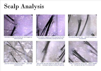 Hair And Scalp Wellness: Sample Scalp Analysis