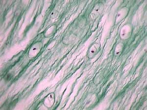 Histology Slides: Fibrocartilage