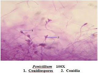 Deuteromycotina | BIOLOGIPEDIA
