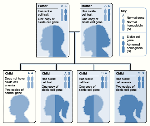 Sickle Cell Anemia Disease: How is sickle cell inherited?