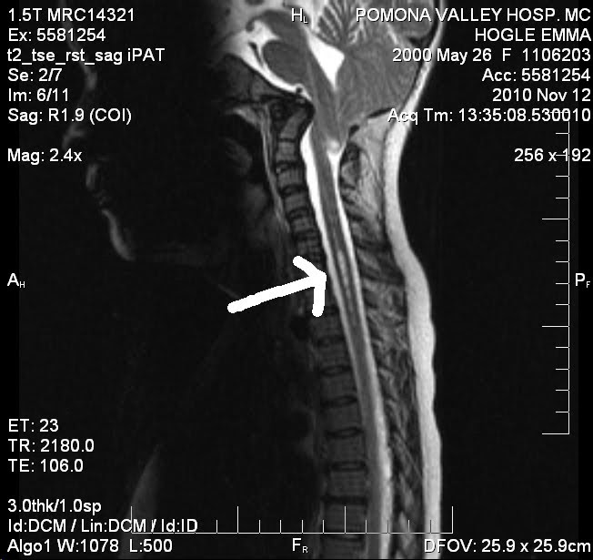 Little Miss Emma Kate: Syrinx