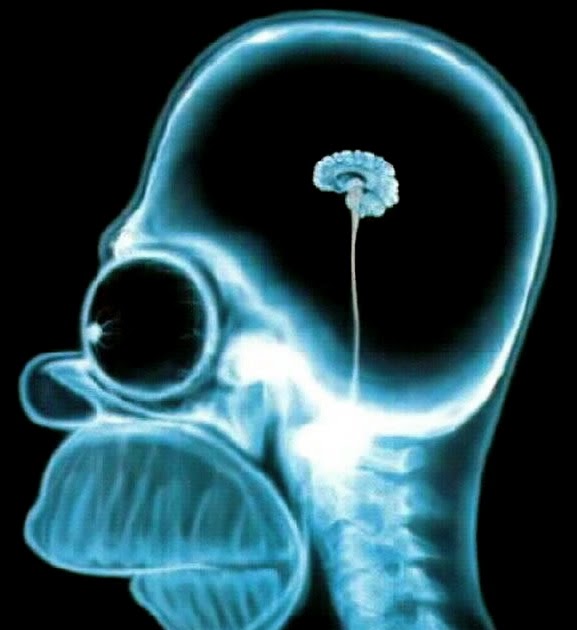 The Necro Files: Artificial Intelligence Anonymous part Deux Ex Machina