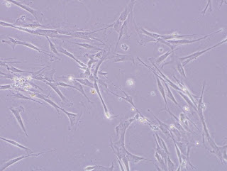 wedonknow.blogspot.com (:: Culturing MRC-5 cell lines