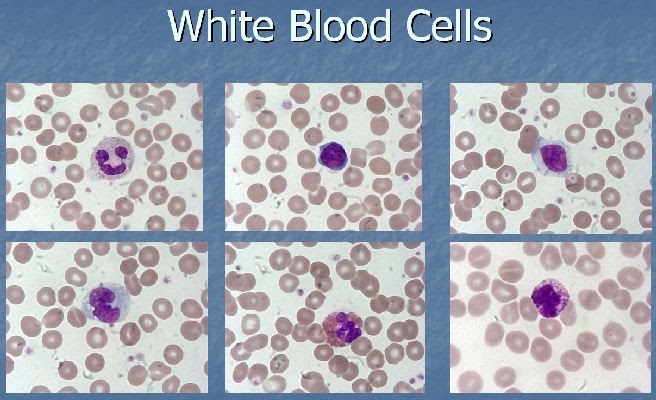 A Dull Day At Work...?: December 8 2010 (Wednesday) - Blood Films Revisited