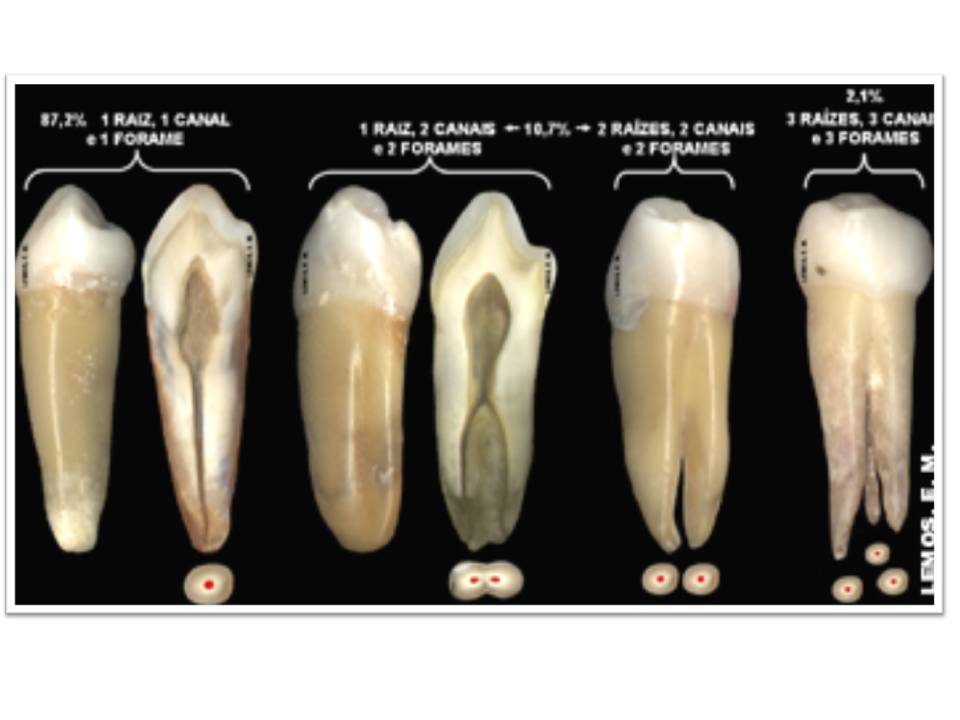 Anatomia Pré Molar Inferior - RETOEDU